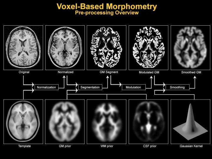 PPT - VBM Voxel-based morphometry PowerPoint Presentation - ID:5676602 PPT - VBM Voxel-based morphometry PowerPoint Presentation - ID:5676602