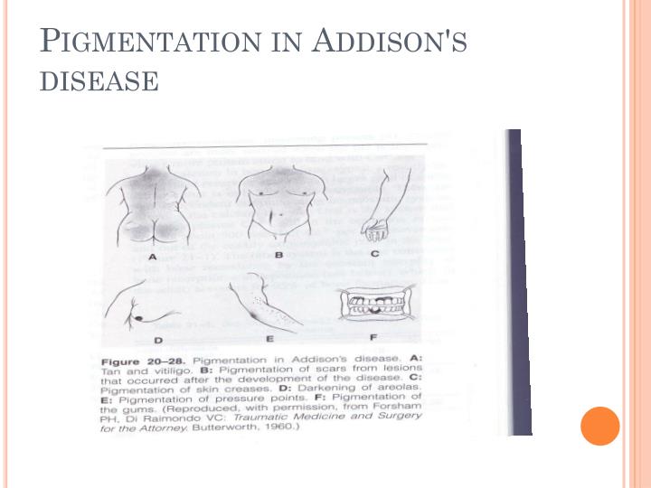 PPT - Adrenal Gland PowerPoint Presentation - ID:5677128