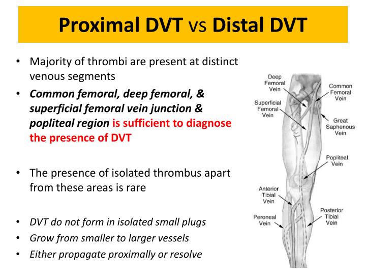 PPT - The Evaluation of DVT – Bedside Ultrasound Diagnosis & Evaluation ...