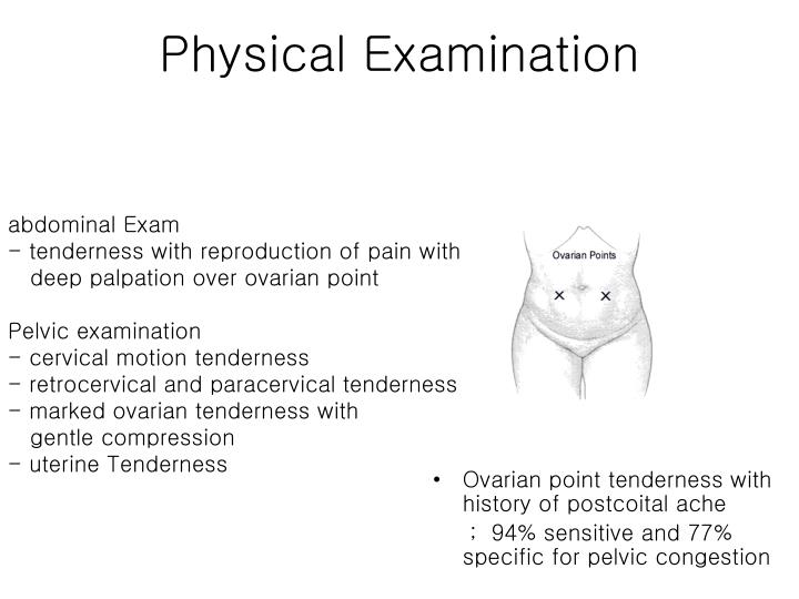 PPT - Chronic Pelvic Pain Pelvic Congestion Syndrome PowerPoint ...