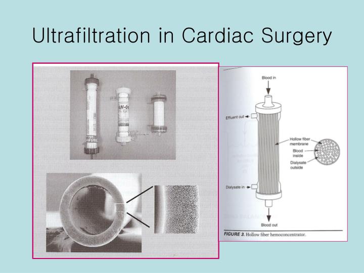 PPT - Blood Conservation in Cardiopulmonary Bypass PowerPoint ...