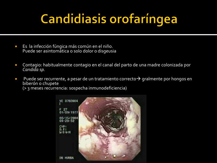 PPT - Seminario de Odontopediatría Herpes y Cándida PowerPoint ...