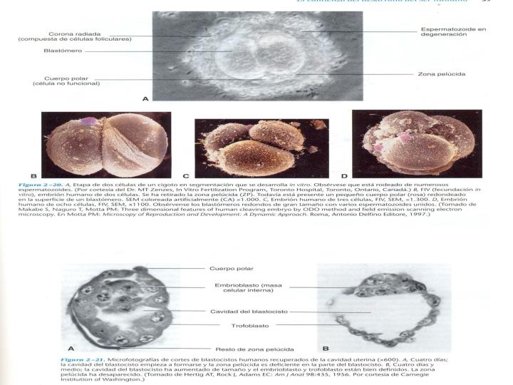 PPT - SEGMENTACION DEL CIGOTO PowerPoint Presentation - ID:5684951
