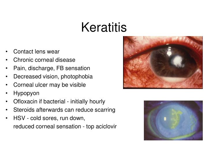 PPT - Red Eye PowerPoint Presentation - ID:5685691