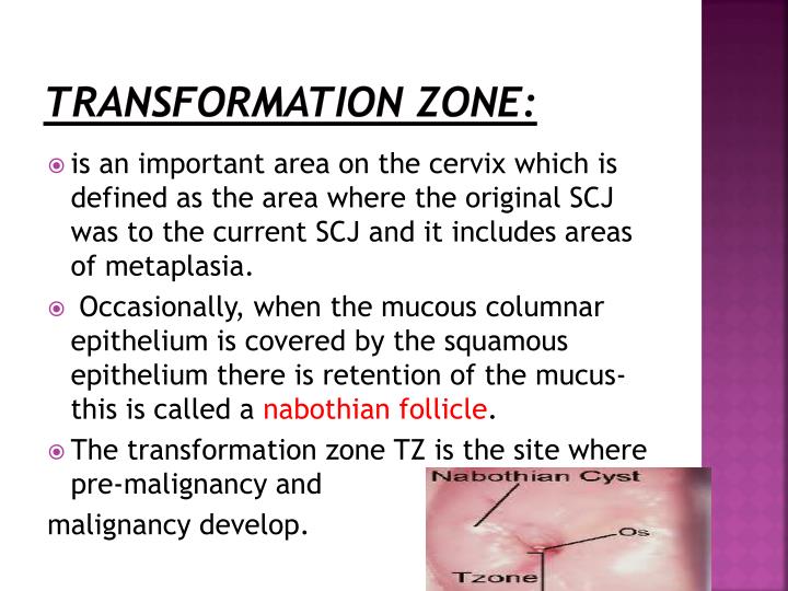 PPT - Premalignant conditions of the cervix PowerPoint Presentation ...