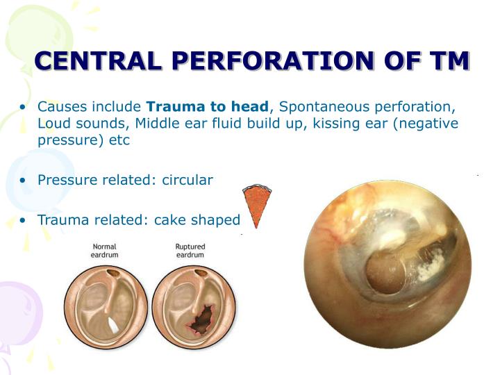 PPT - OTOSCOPY & OPTHALMOSCOP Y PowerPoint Presentation - ID:5687761