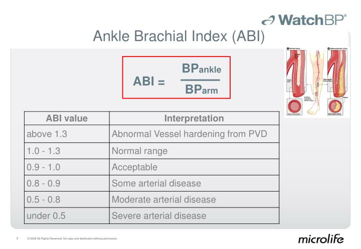 PPT - Microlife microlife PowerPoint Presentation - ID:5688480