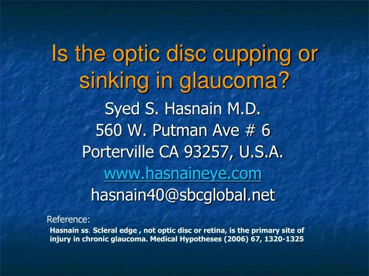 PPT - Is the optic disc cupping or sinking in glaucoma? PowerPoint ...