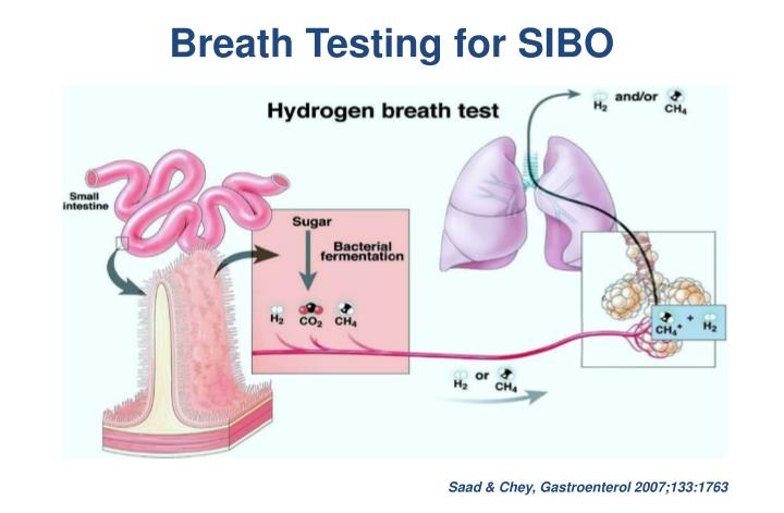 PPT - Small Intestinal Bacterial Overgrowth PowerPoint Presentation ...