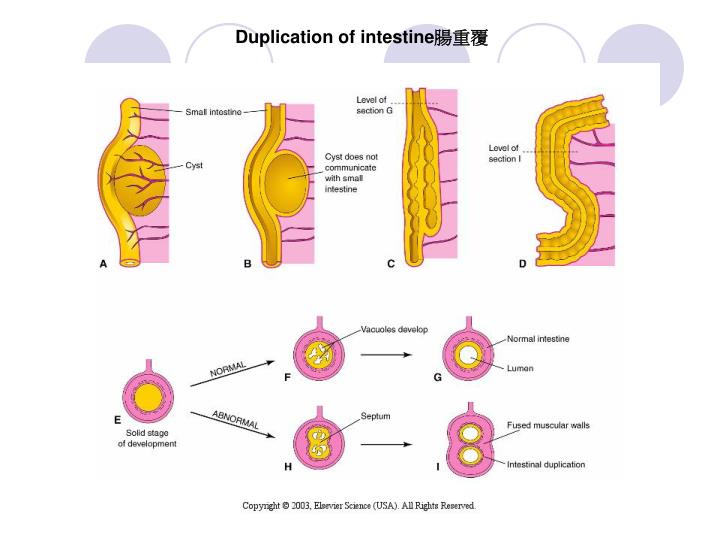 PPT - Development of GI system PowerPoint Presentation - ID:5693177