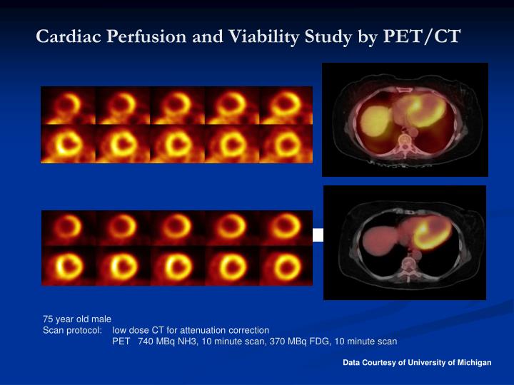 PPT - Myocardial Viability PowerPoint Presentation - ID:5695177