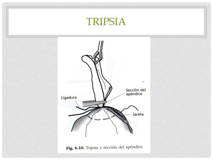 PPT - LAPAROTOMIA EXPLOradora PowerPoint Presentation - ID:5695598