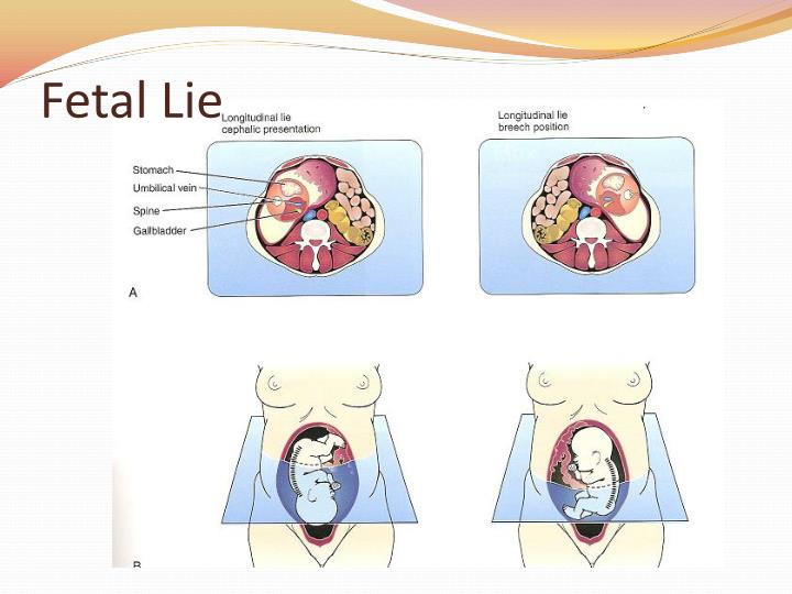 PPT - Obstetrical Measurements 2 nd & 3 rd Trimester PowerPoint ...