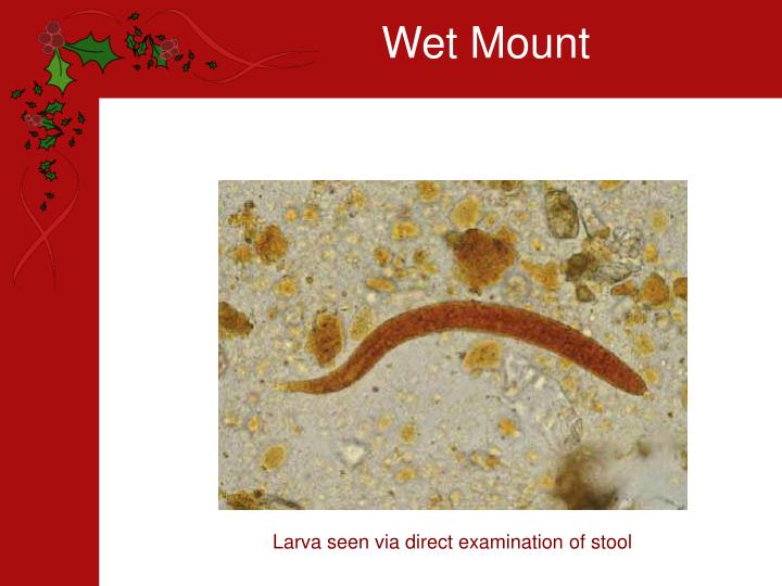 PPT - Strongyloides PowerPoint Presentation - ID:5698272