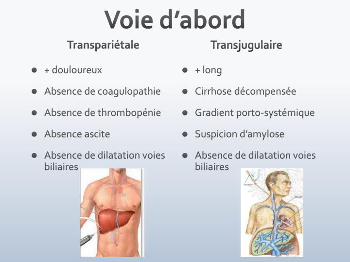 PPT - Que reste-t-il des indications de la ponction biopsie hépatique ...