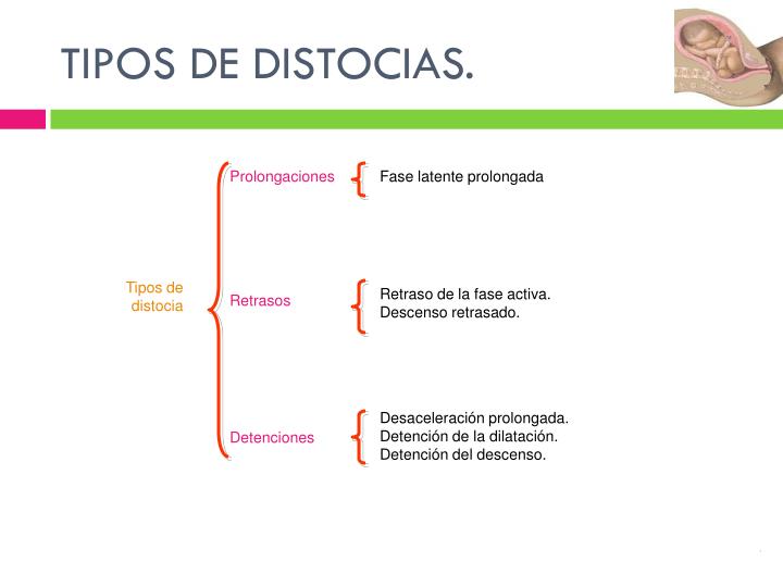PPT - DistociaS PowerPoint Presentation - ID:5702270