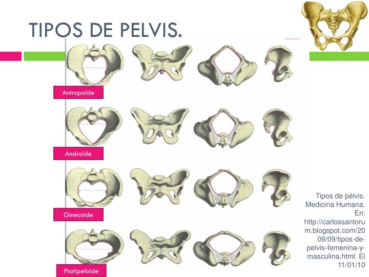 PPT - DistociaS PowerPoint Presentation - ID:5702270