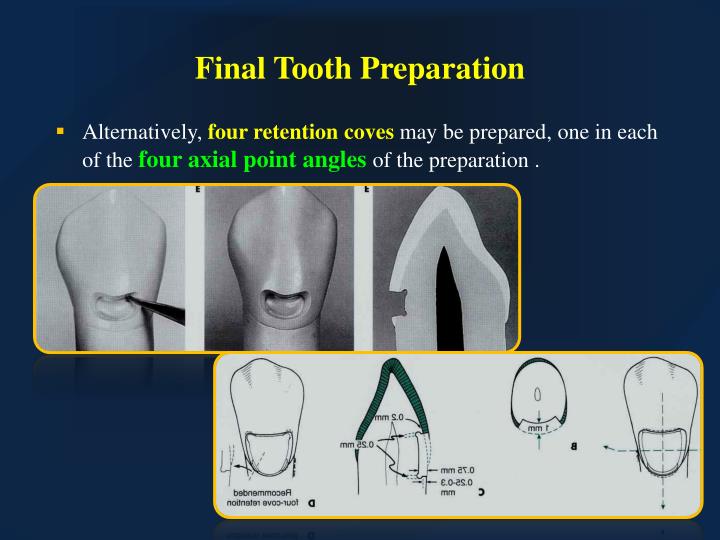 PPT - Class I & V Cavity preparation for Amalgam Restoration PowerPoint ...