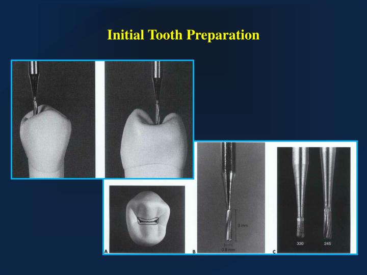 PPT - Class I & V Cavity preparation for Amalgam Restoration PowerPoint ...