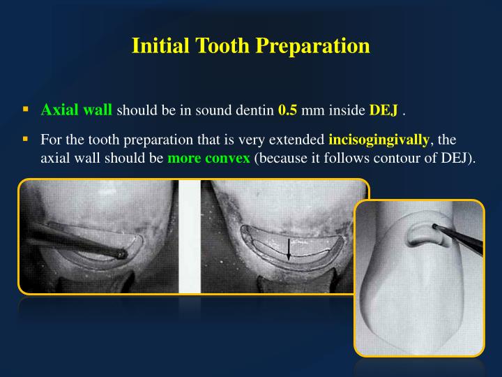 PPT - Class I & V Cavity preparation for Amalgam Restoration PowerPoint ...