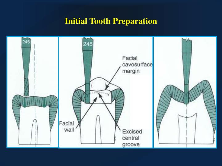 PPT - Class I & V Cavity preparation for Amalgam Restoration PowerPoint ...