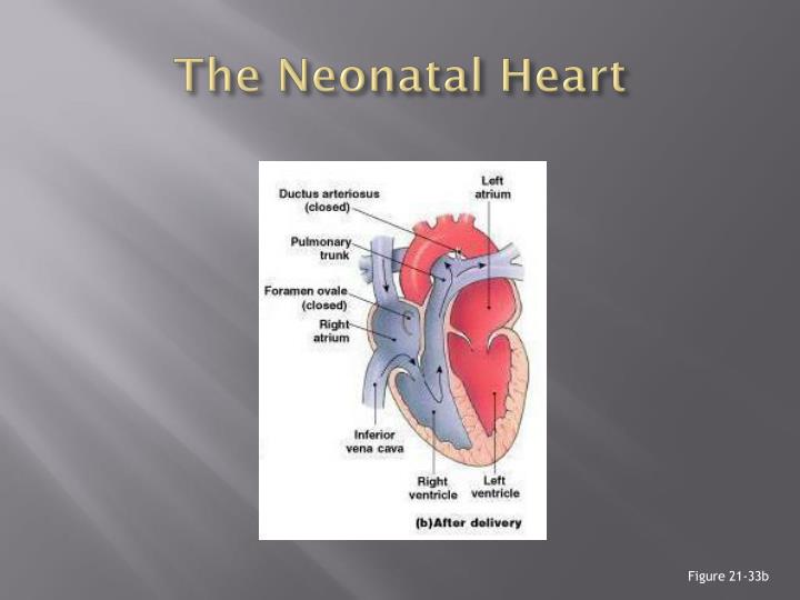 PPT - Portal hepatic vein. Foetal circulation PowerPoint Presentation ...