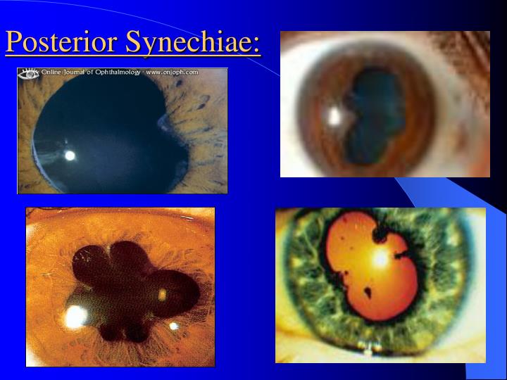 PPT - Ocular Diagnostics PowerPoint Presentation - ID:5704755