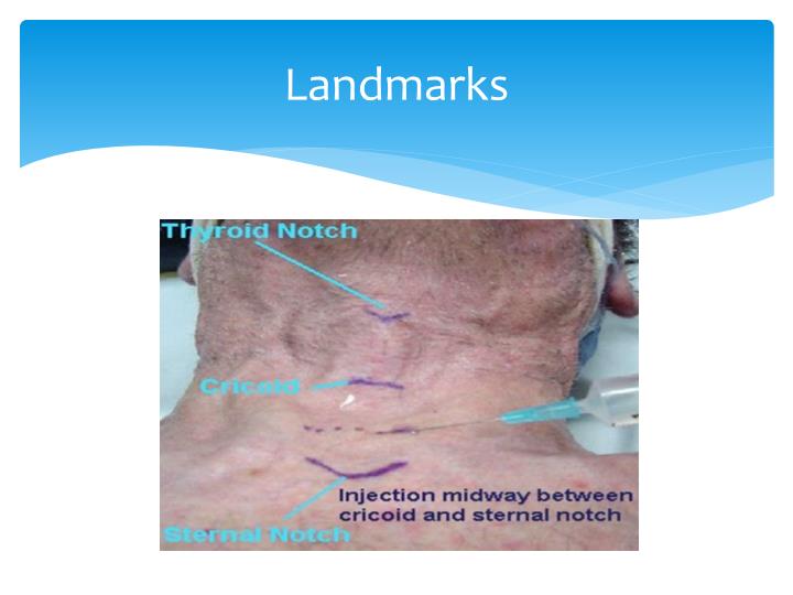 PPT - Tracheostomy Care PowerPoint Presentation - ID:5705059