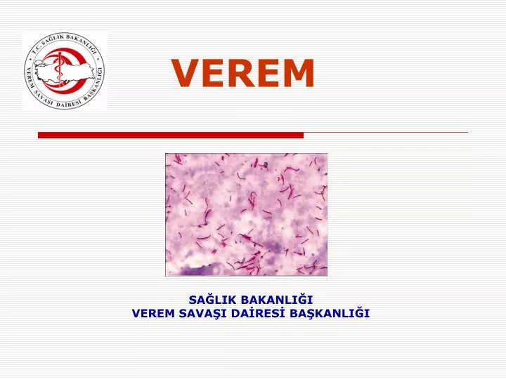 PPT - VEREM PowerPoint Presentation, free download - ID:5705930