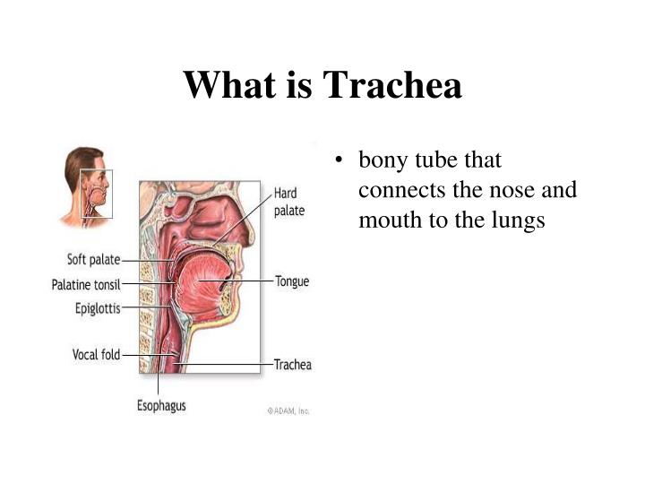 PPT - TRACHEA PowerPoint Presentation - ID:5708611