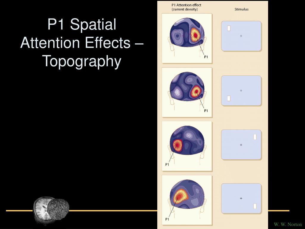 Ppt קשב נוירואנטומיה ונוירופיזיולוגיה Powerpoint Presentation Id
