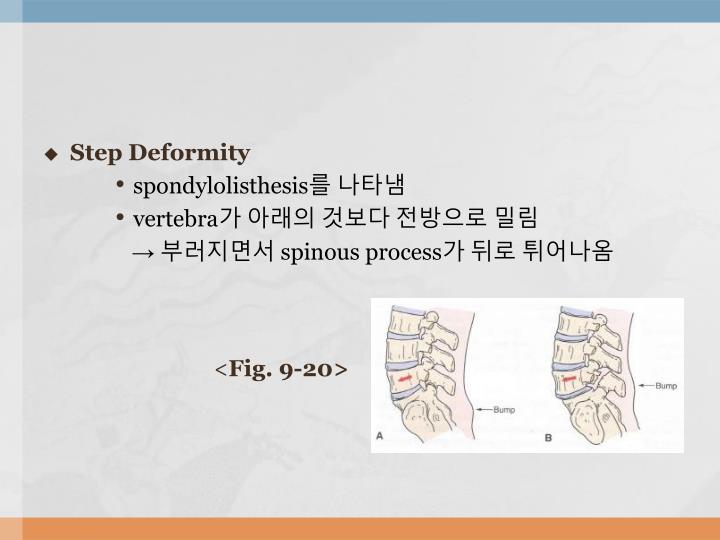 PPT - Lumbar spine ( 요추 ) PowerPoint Presentation - ID:5713892