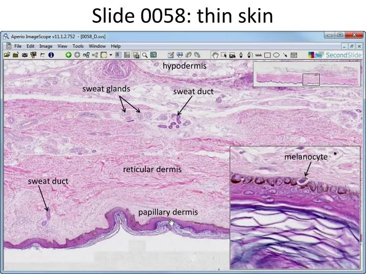 PPT - Slide 0058: thin skin PowerPoint Presentation, free download - ID ...
