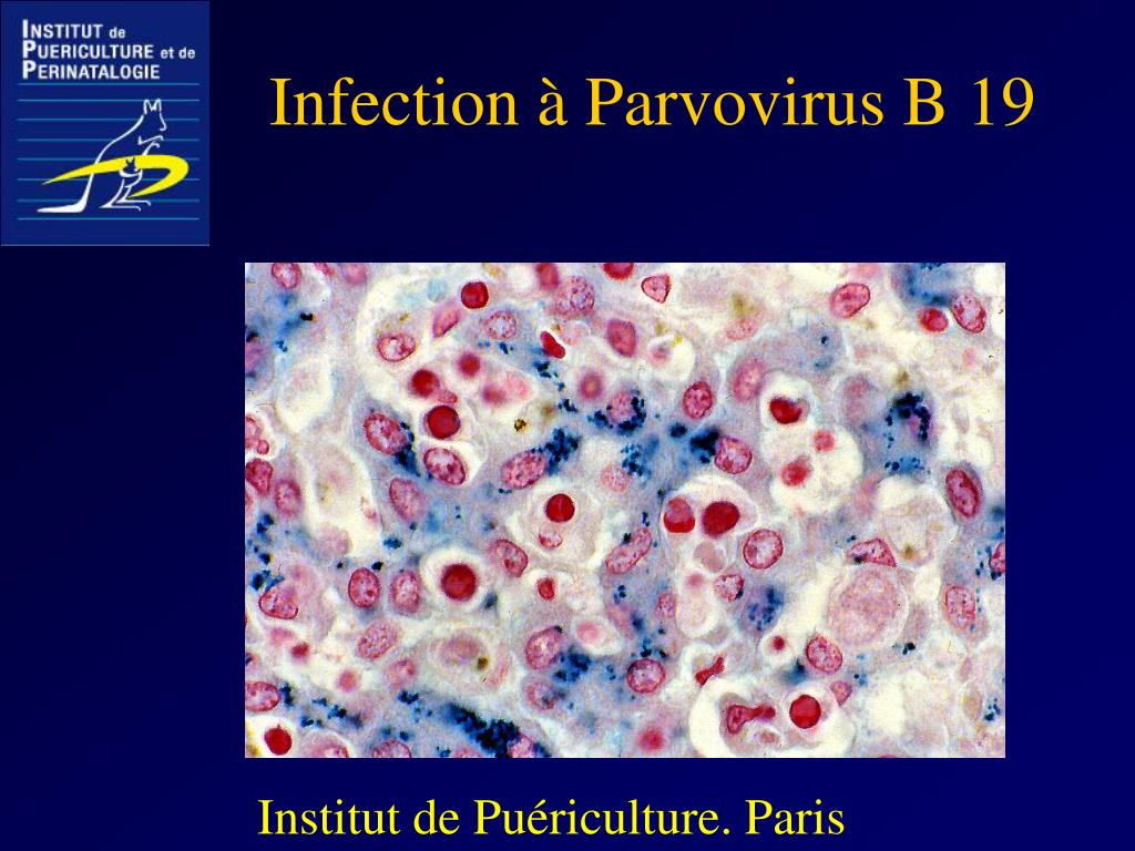 Ppt Infection à Parvovirus B 19 Powerpoint Presentation Free
