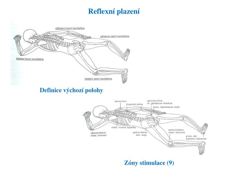 PPT - Vojtova metoda PowerPoint Presentation - ID:5729781