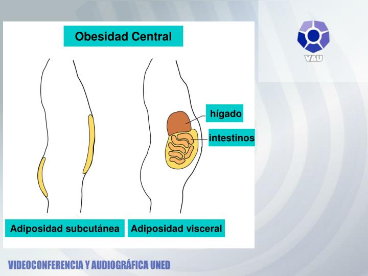 PPT - OBESIDAD Y SÍNDROME METABÓLICO PowerPoint Presentation - ID:5731533