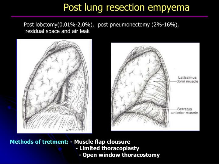 PPT - PLEURAL EMPYEMA PowerPoint Presentation - ID:5735694