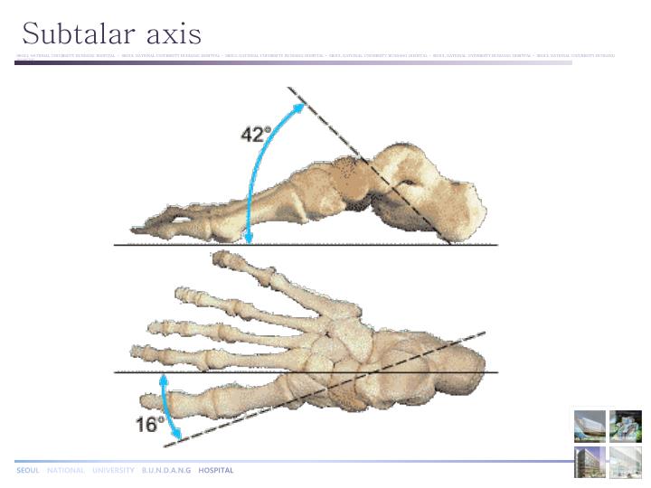 PPT - Function of the foot in normal gait PowerPoint Presentation - ID ...