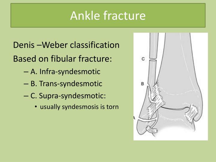 PPT - Common lower limb fracture PowerPoint Presentation - ID:5737068