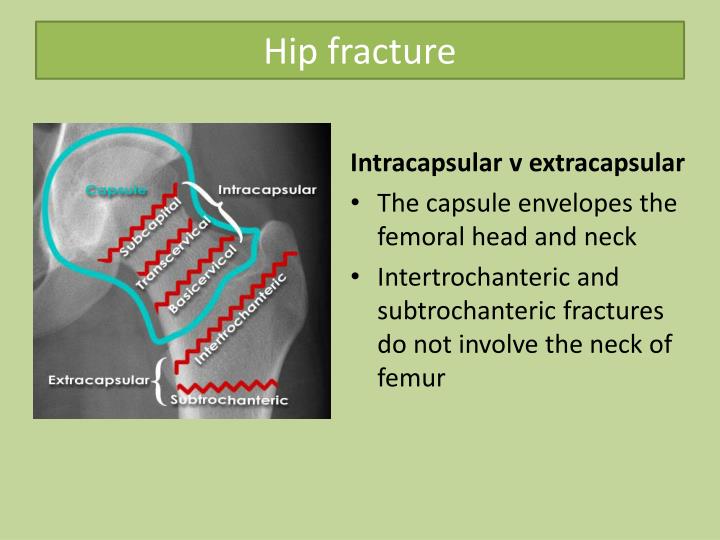 PPT - Common lower limb fracture PowerPoint Presentation - ID:5737068