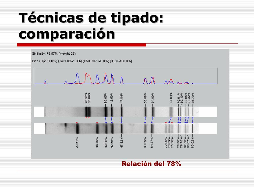 PPT - Álvaro Pascual UGC de Enfermedades Infecciosas y Microbiología ...
