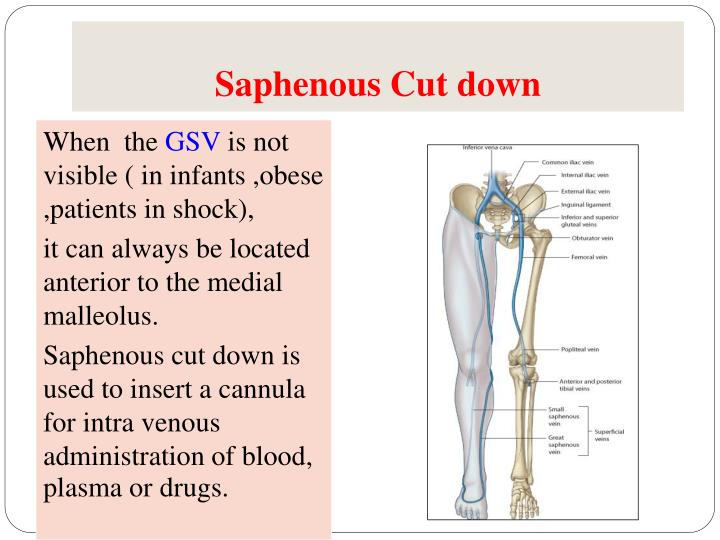 PPT - ARTERIES AND VEINS OF THE LOWER LIMB PowerPoint Presentation - ID ...