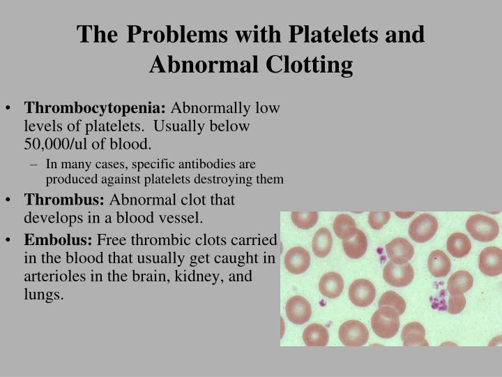 PPT - Major Functions of Blood PowerPoint Presentation - ID:5740688