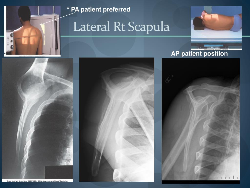X Ray Positioning Chart Testing Procedure For A Chest Radiograph X Ray Positioning Chart Testing Procedure For A Chest Radiograph