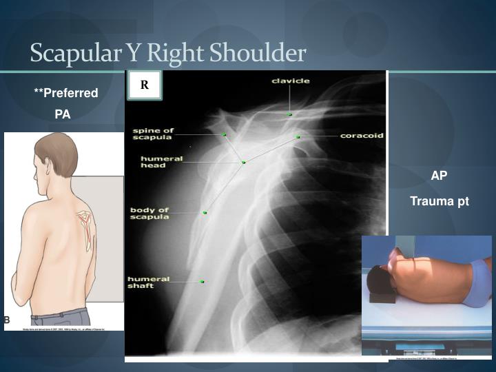 PPT - Shoulder girdle PowerPoint Presentation - ID:5740918