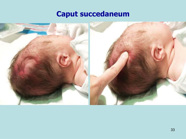 PPT - Normal Newborn care Neonatal care PowerPoint Presentation - ID ...