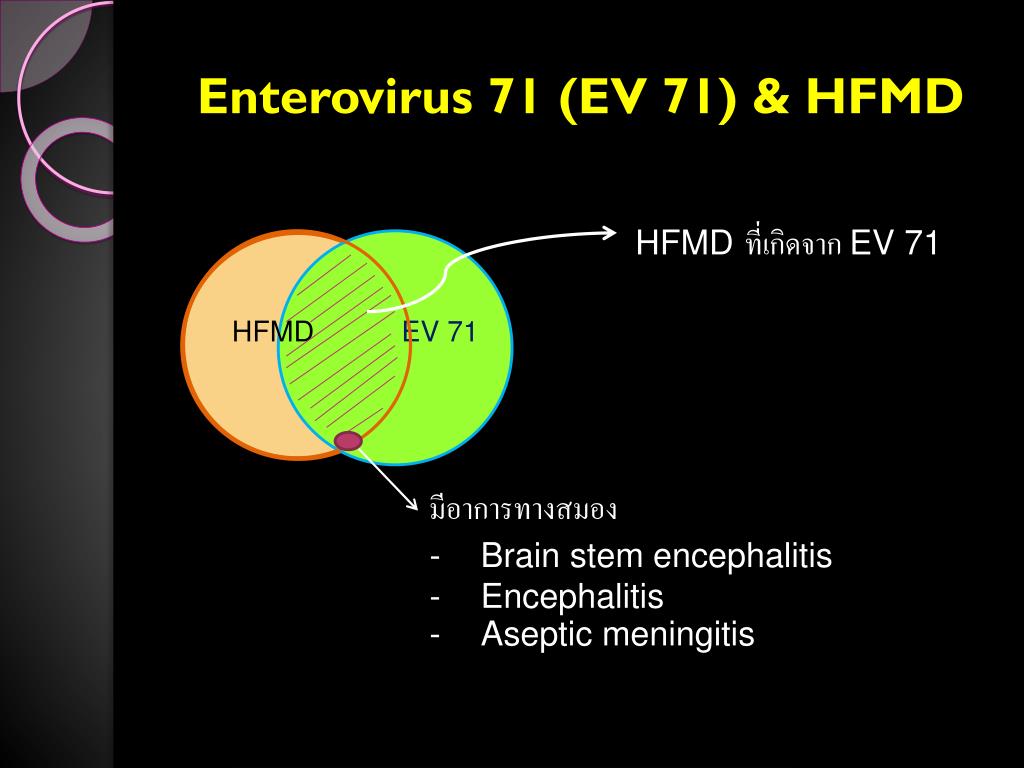 PPT - Hand-Foot-Mouth Disease/ Enterovirus 71 PowerPoint Presentation ...