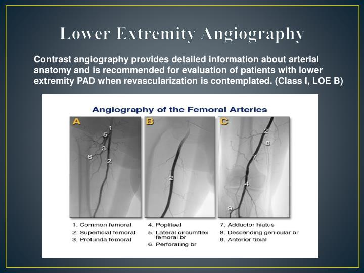 PPT - Going out on a Limb: Peripheral Arterial Disease in Primary Care ...