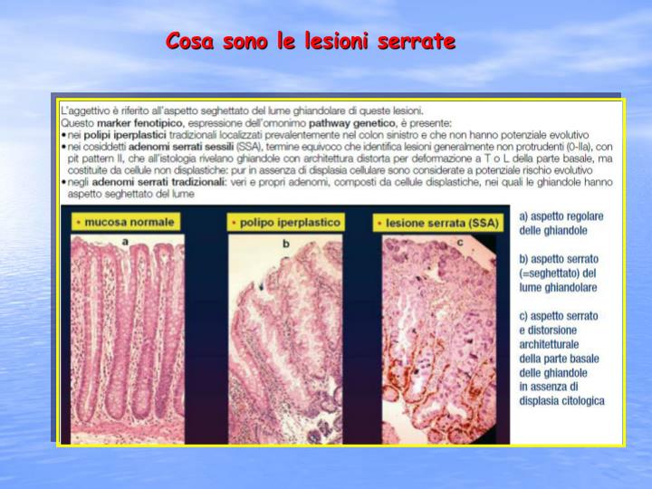 PPT - Nuova classificazione e follow-up dei polipi colorettali ...