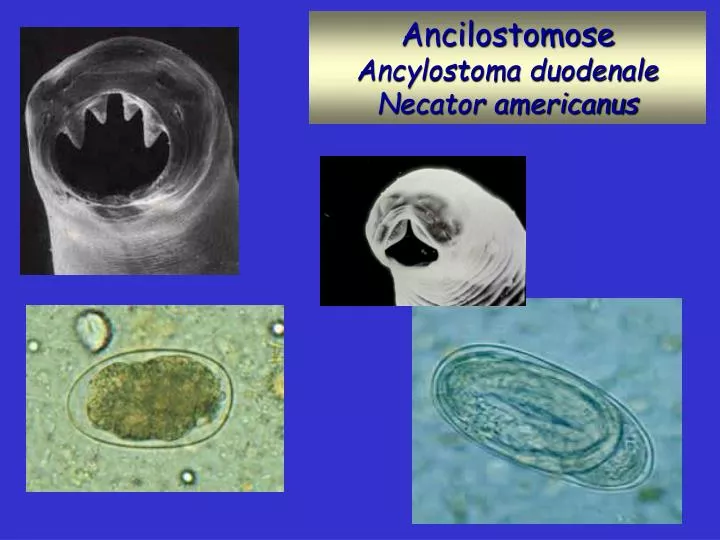 PPT - Ancilostomose Ancylostoma duodenale Necator americanus PowerPoint ...